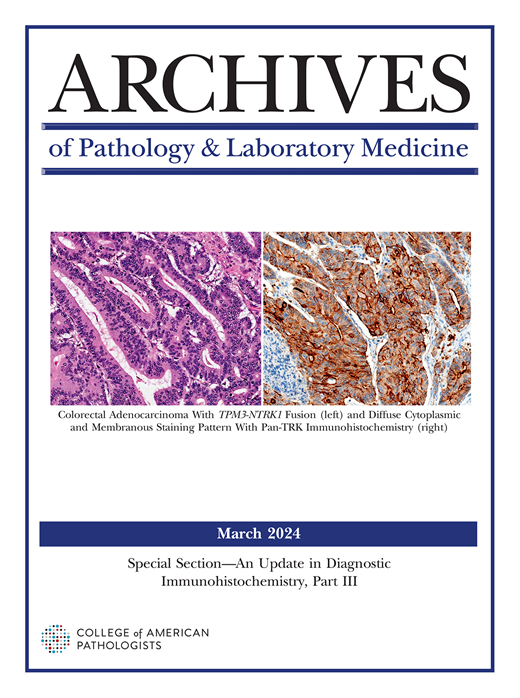 Cholangiocarcinoma Pathologic And Molecular Classification In The Era Of Precision Medicine